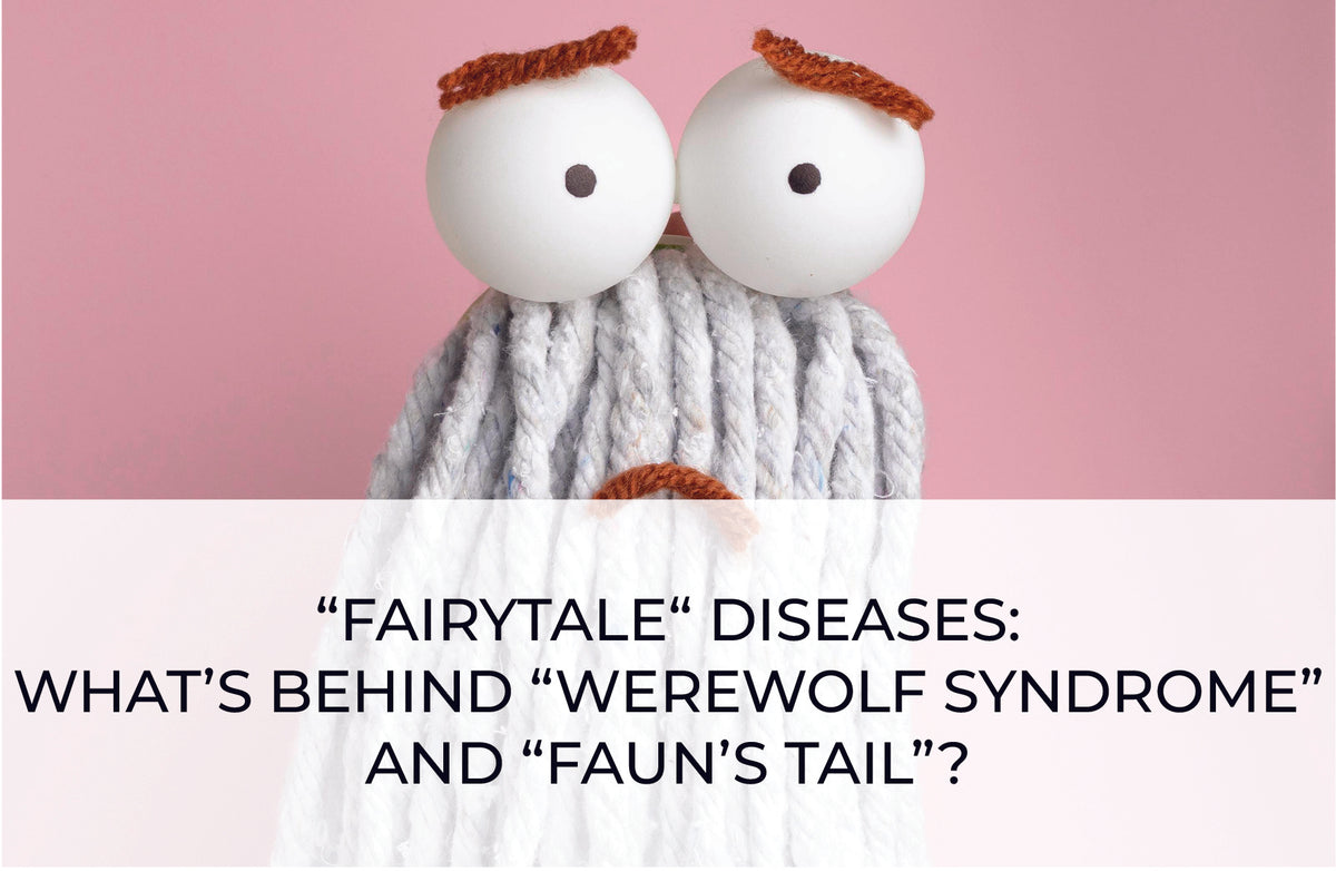"FAIRYTALE" DISEASES: WHAT'S BEHIND "WEREWOLF SYNDROME" AND "FAUN TAIL ...